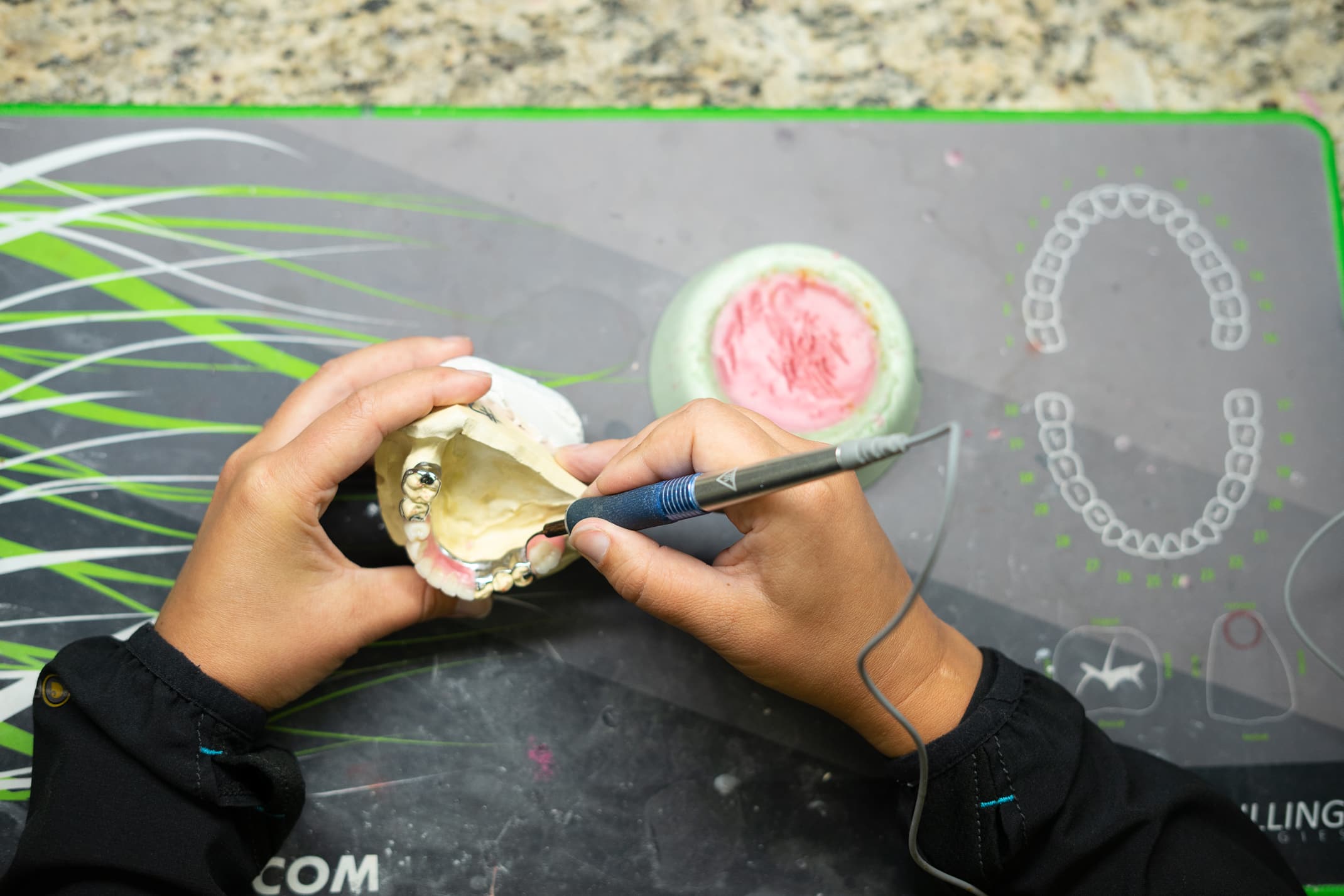 Porcelain Crowns | West Dental Implants & Prosthetics | Dentist in ...